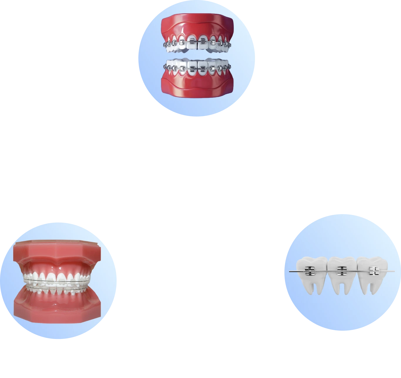 Orthodontic Clinic: Perfectly Aligned Smiles | TAM Dental